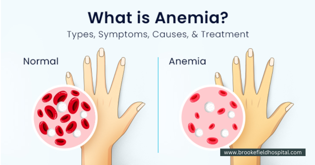 Anemic People Anemic People